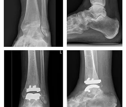 Fuß und Sprunggelenk